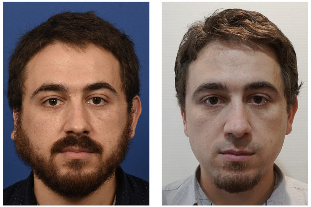 Photo Gallery | Center for Advanced Parotid Surgery in Beverly Hills, CA