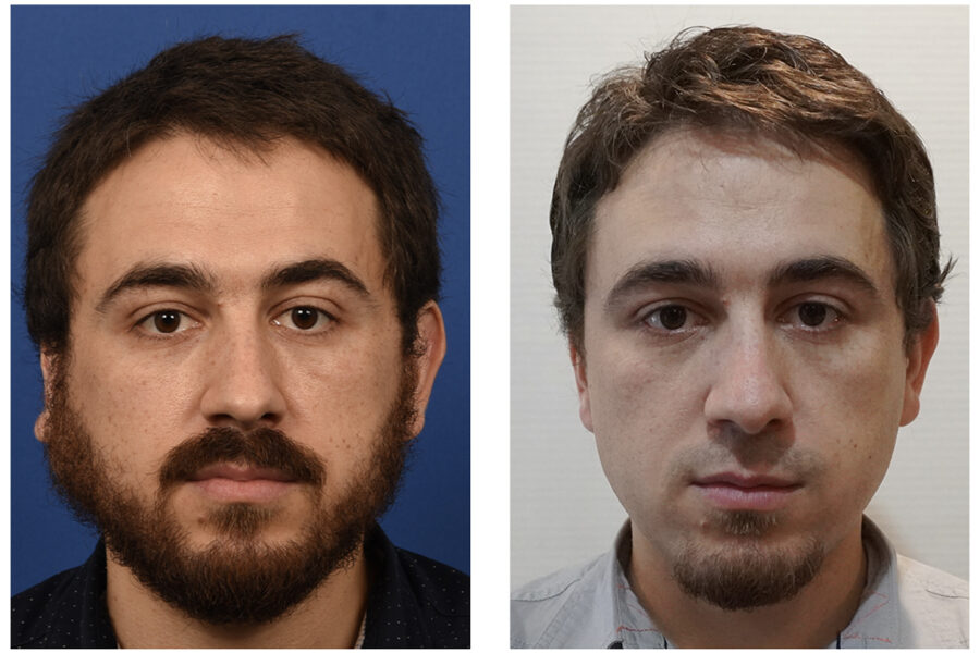 Photo Gallery | Center for Advanced Parotid Surgery in Beverly Hills, CA