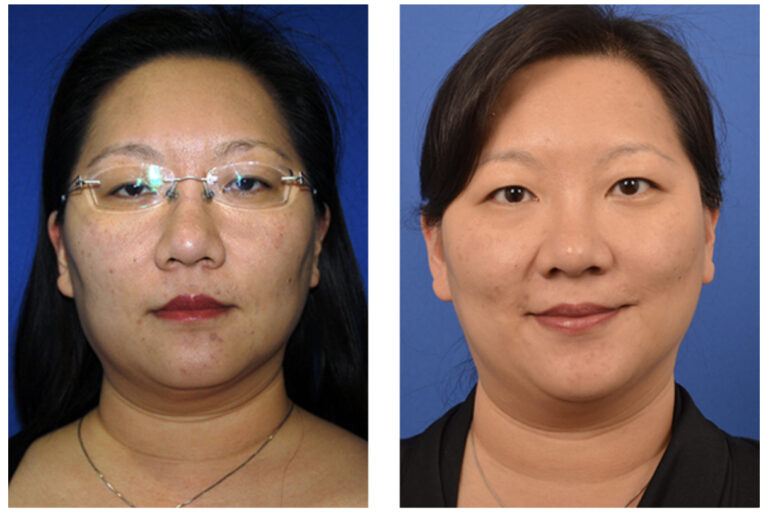 Photo Gallery | Center for Advanced Parotid Surgery in Beverly Hills, CA