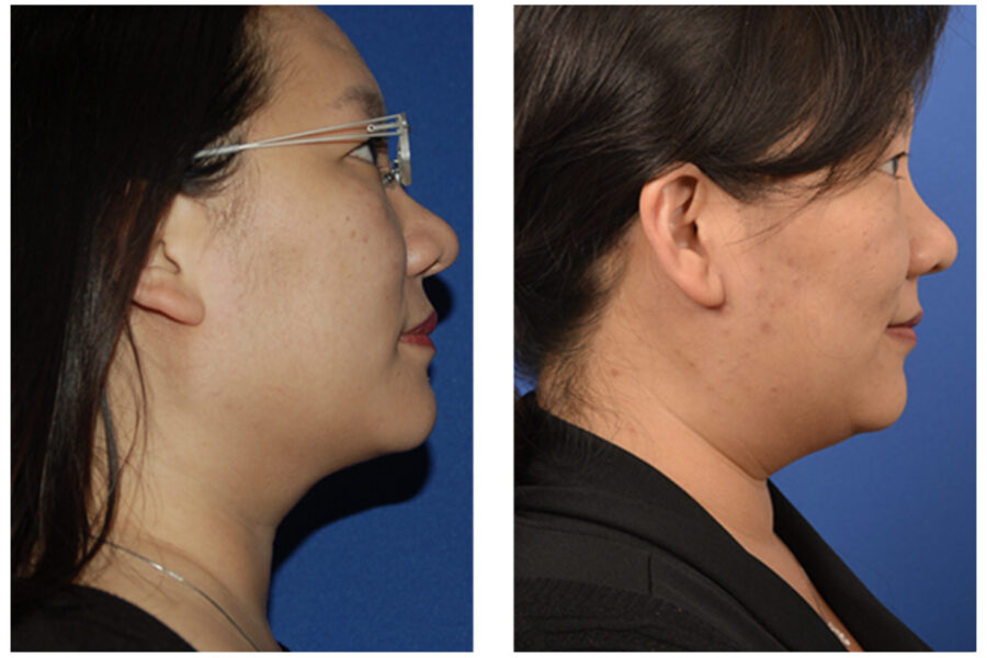 Photo Gallery | Center for Advanced Parotid Surgery in Beverly Hills, CA
