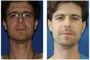 Photo Gallery | Center for Advanced Parotid Surgery in Beverly Hills, CA