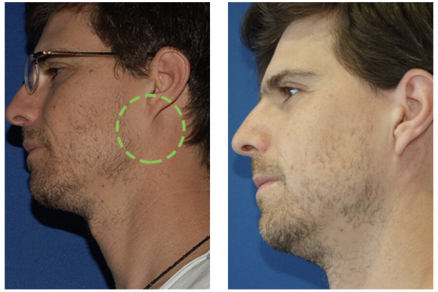 Photo Gallery | Center for Advanced Parotid Surgery in Beverly Hills, CA