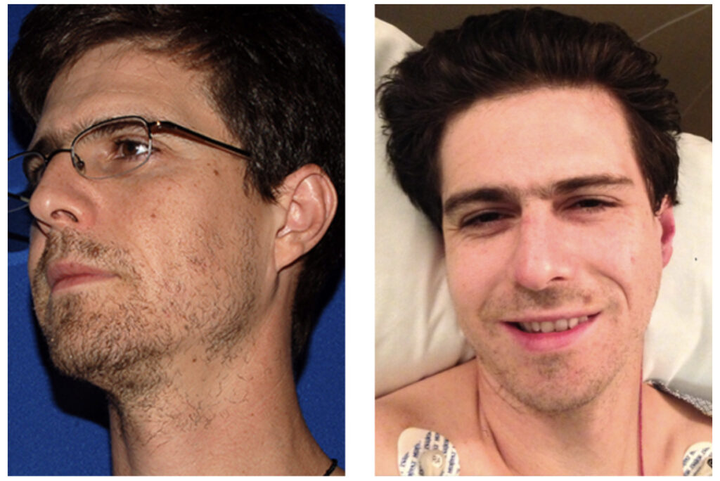 Photo Gallery | Center for Advanced Parotid Surgery in Beverly Hills, CA