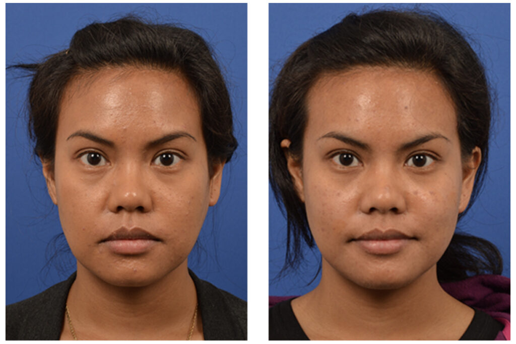 Photo Gallery | Center for Advanced Parotid Surgery in Beverly Hills, CA