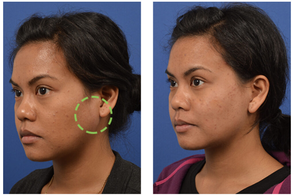 Photo Gallery | Center for Advanced Parotid Surgery in Beverly Hills, CA