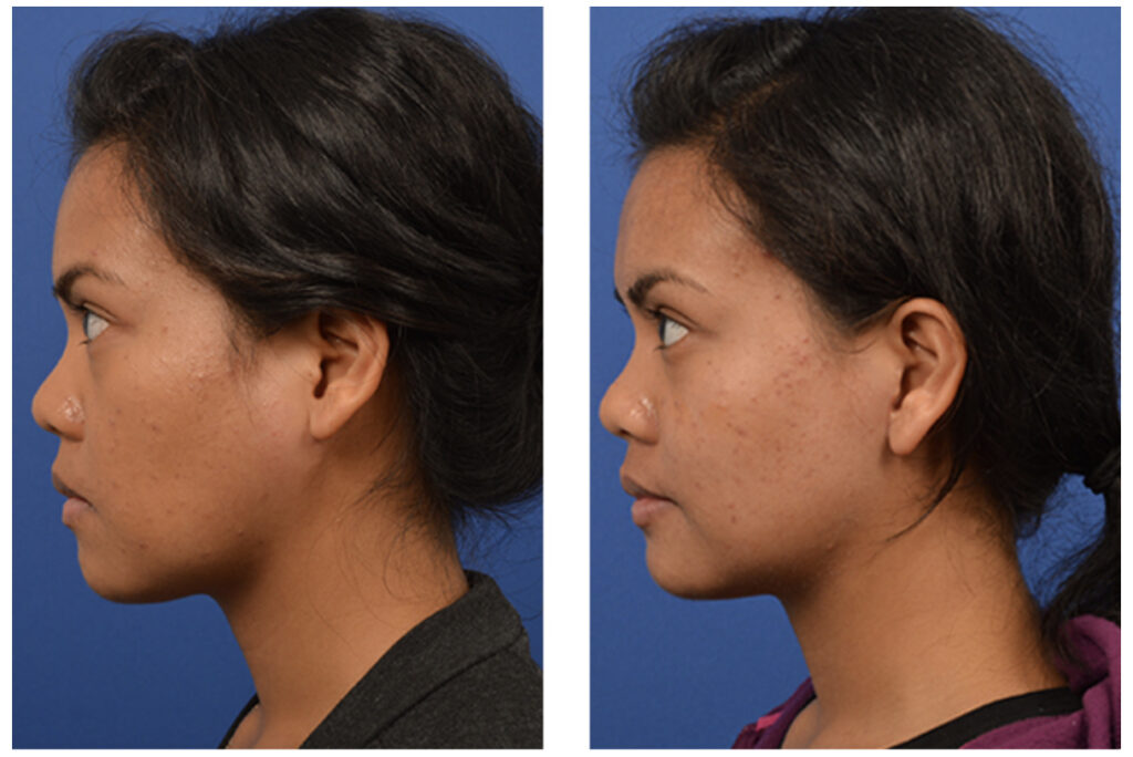 Photo Gallery | Center for Advanced Parotid Surgery in Beverly Hills, CA