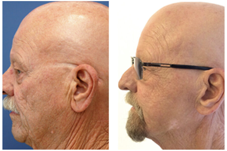 Photo Gallery | Center for Advanced Parotid Surgery in Beverly Hills, CA