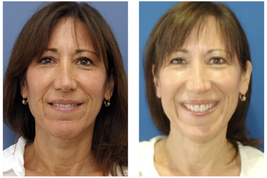 Photo Gallery | Center for Advanced Parotid Surgery in Beverly Hills, CA