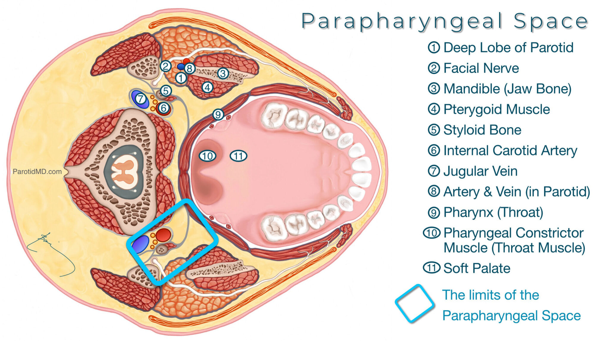 Parapharyngeal Tumors in Beverly Hills, CA | Center for Advanced ...