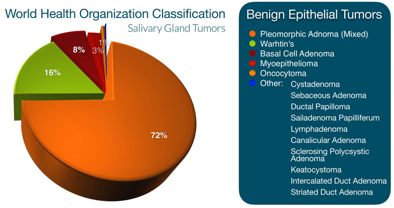 Parotid Benign Tumors in Beverly Hills, CA | Center for Advanced ...