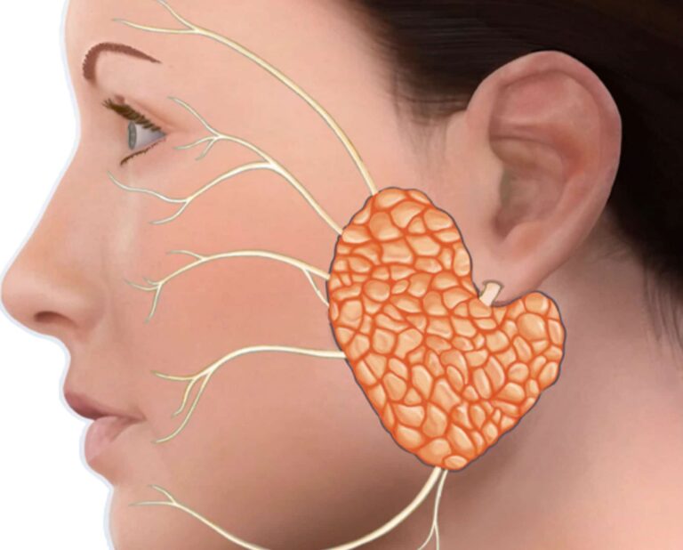 Bilateral Parotid Gland Enlargement: Causes, Symptoms, and When to See ...
